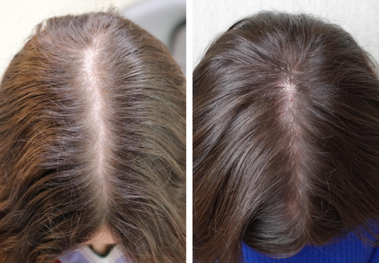 Hair Bond - Liaison Growth