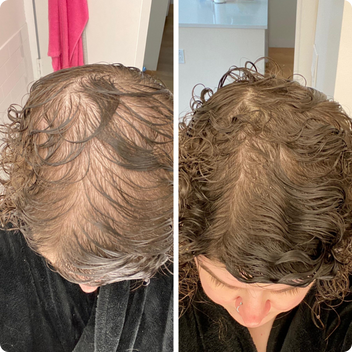Hair Bond - Liaison Growth