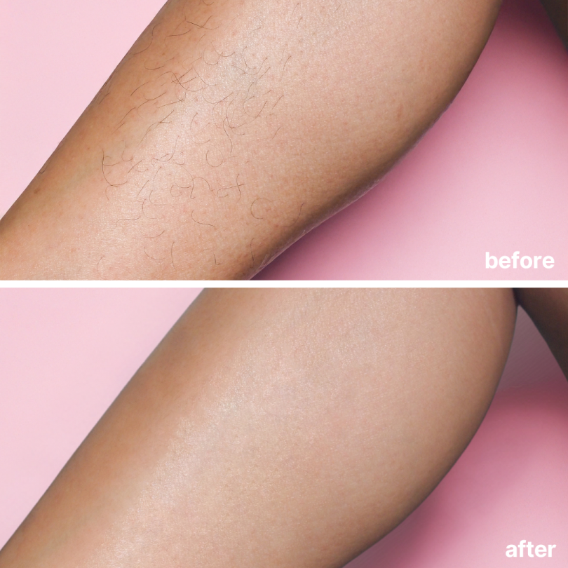 Bare Basics No Shave Hair Removal Cream - Liaison Growth